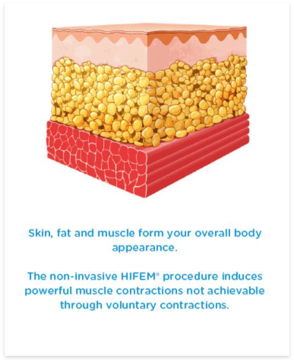 EMSculpt for Injury rehabilitation - Precision Regenerative Medicine ...